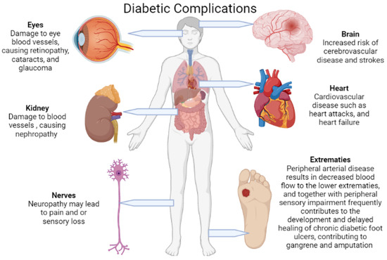 The Effects of Blue Light on Human Fibroblasts and Diabetic Wound Healing