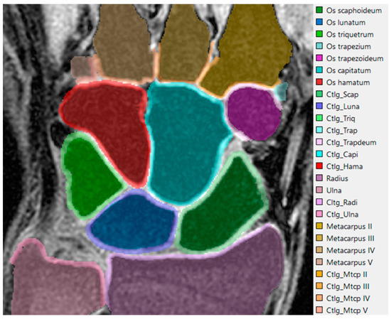 Life | Free Full-Text | Wrist Bone Motion during Flexion-Extension and ...