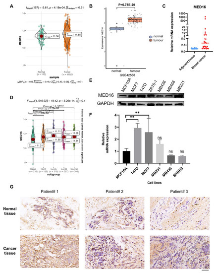 MED16 Promotes Tumour Progression and Tamoxifen Sensitivity by ...