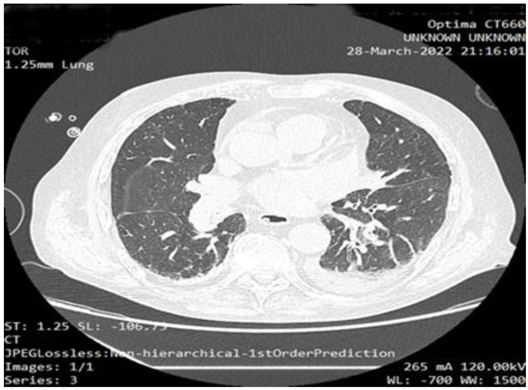 Life | Free Full-Text | The Cumulative Detrimental Effect of COVID-19 ...
