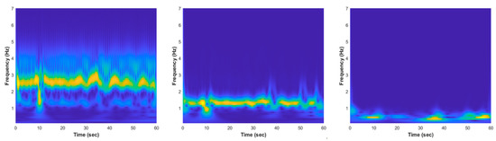 Life | Free Full-Text | A Deep Learning Framework for Automatic Sleep Apnea Classification Based ...