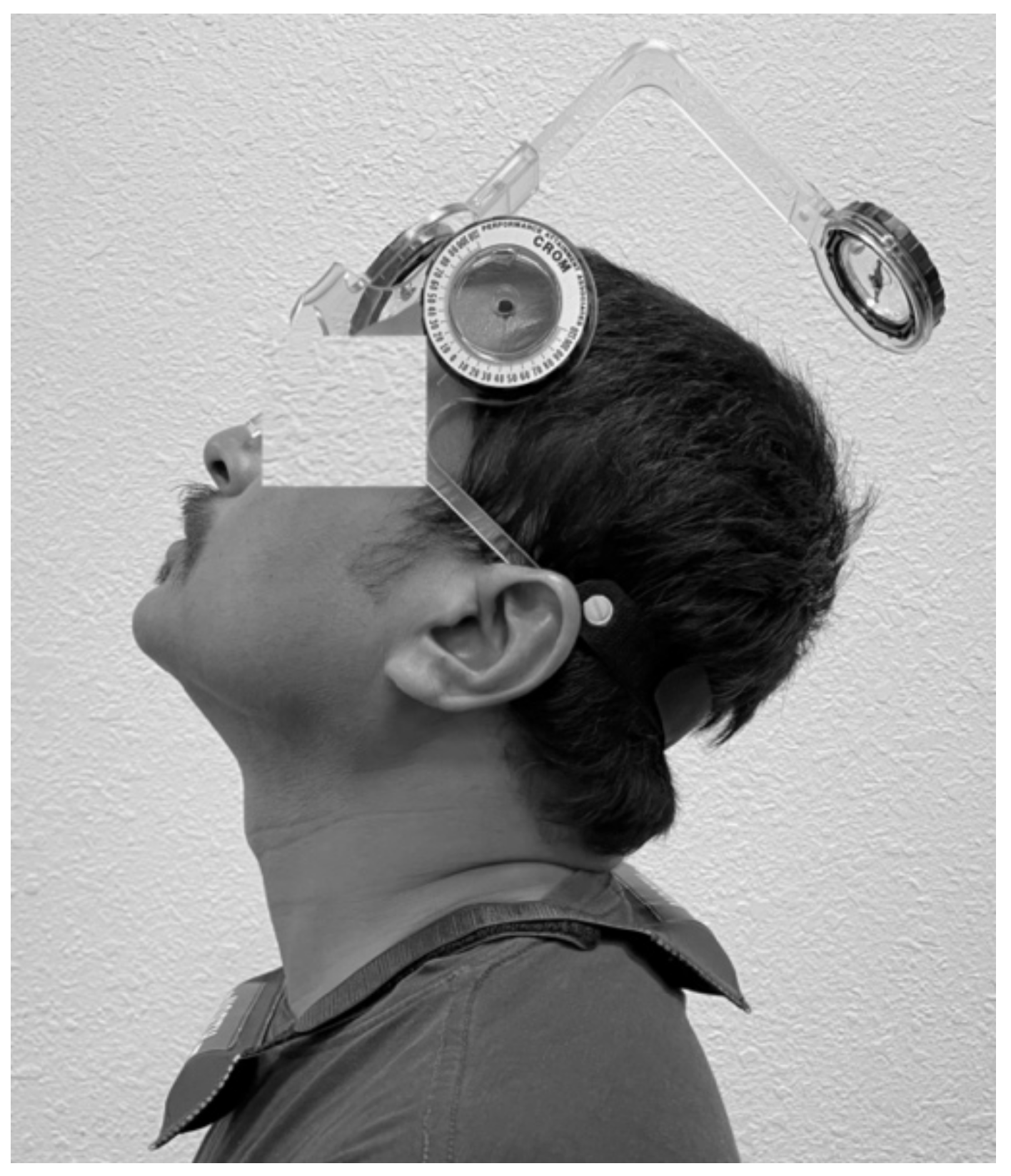 Cervical Joint Position Sense and Its Correlations with Postural ...