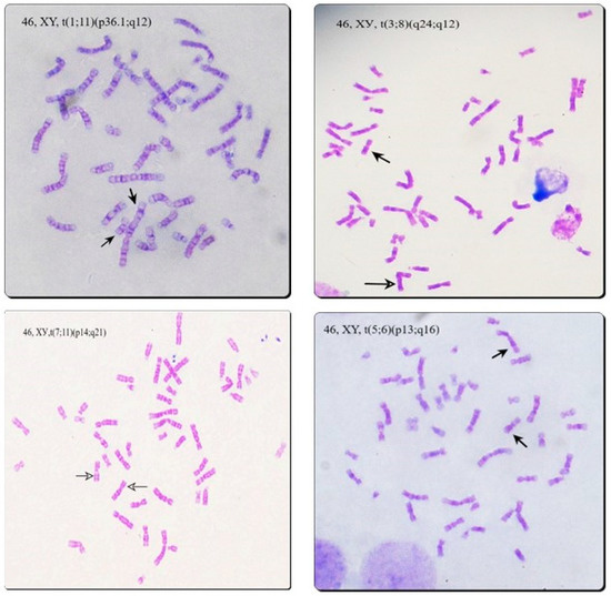 Correlation between Cytogenetic Findings and Spermatogenic Failure in ...