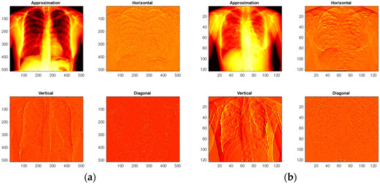 Automatic Detection of Tuberculosis Using VGG19 with Seagull-Algorithm