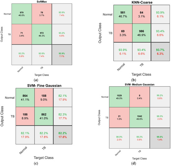 Automatic Detection of Tuberculosis Using VGG19 with Seagull-Algorithm