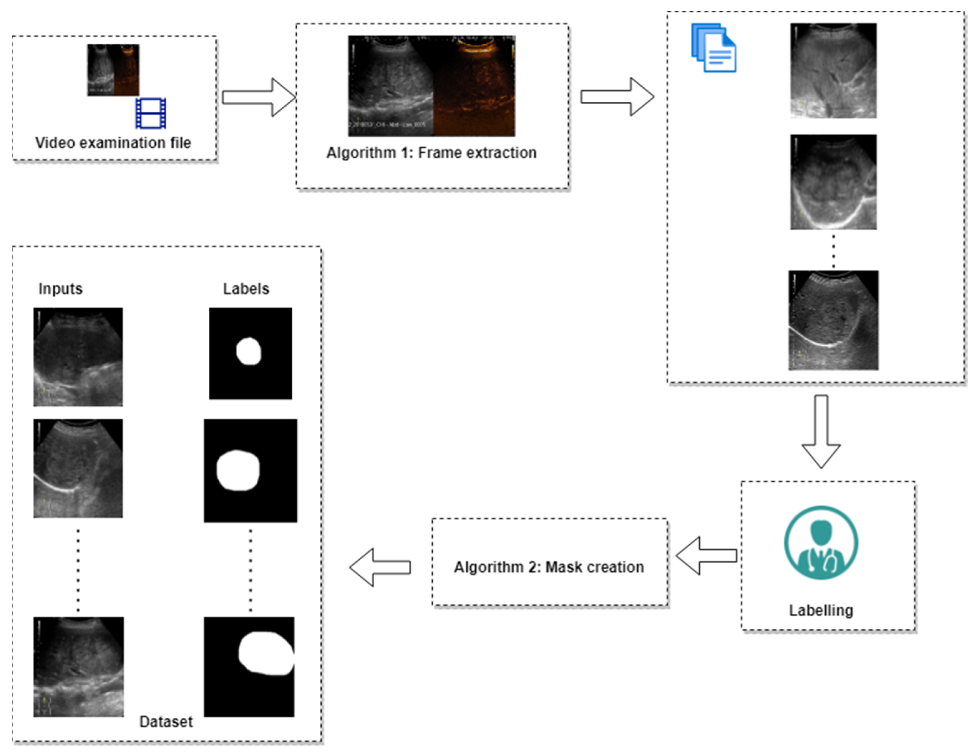 Deep Learning Algorithms in the Automatic Segmentation of Liver Lesions ...