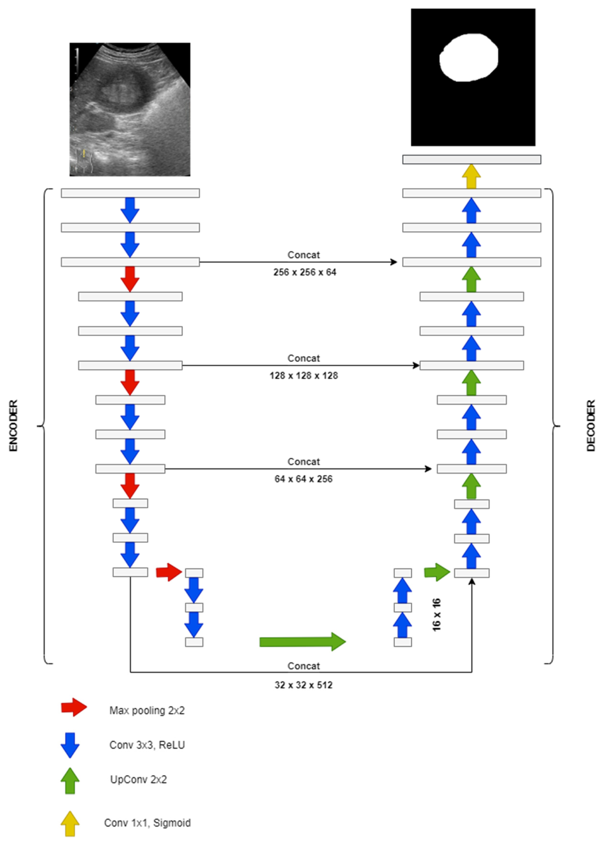 Deep Learning Algorithms in the Automatic Segmentation of Liver Lesions ...