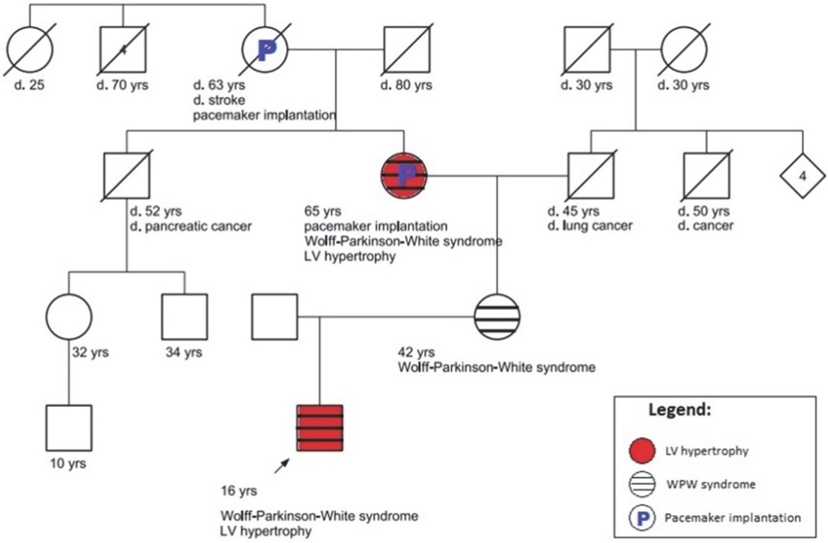 Intrafamilial Phenotypical Variability Linked to PRKAG2 Mutation—Family ...