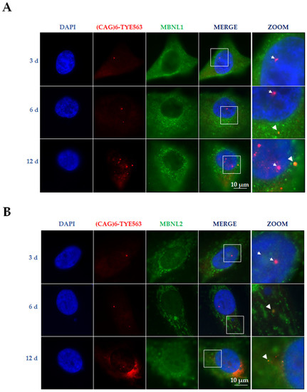 RNA Foci Formation in a Retinal Glial Model for Spinocerebellar Ataxia ...