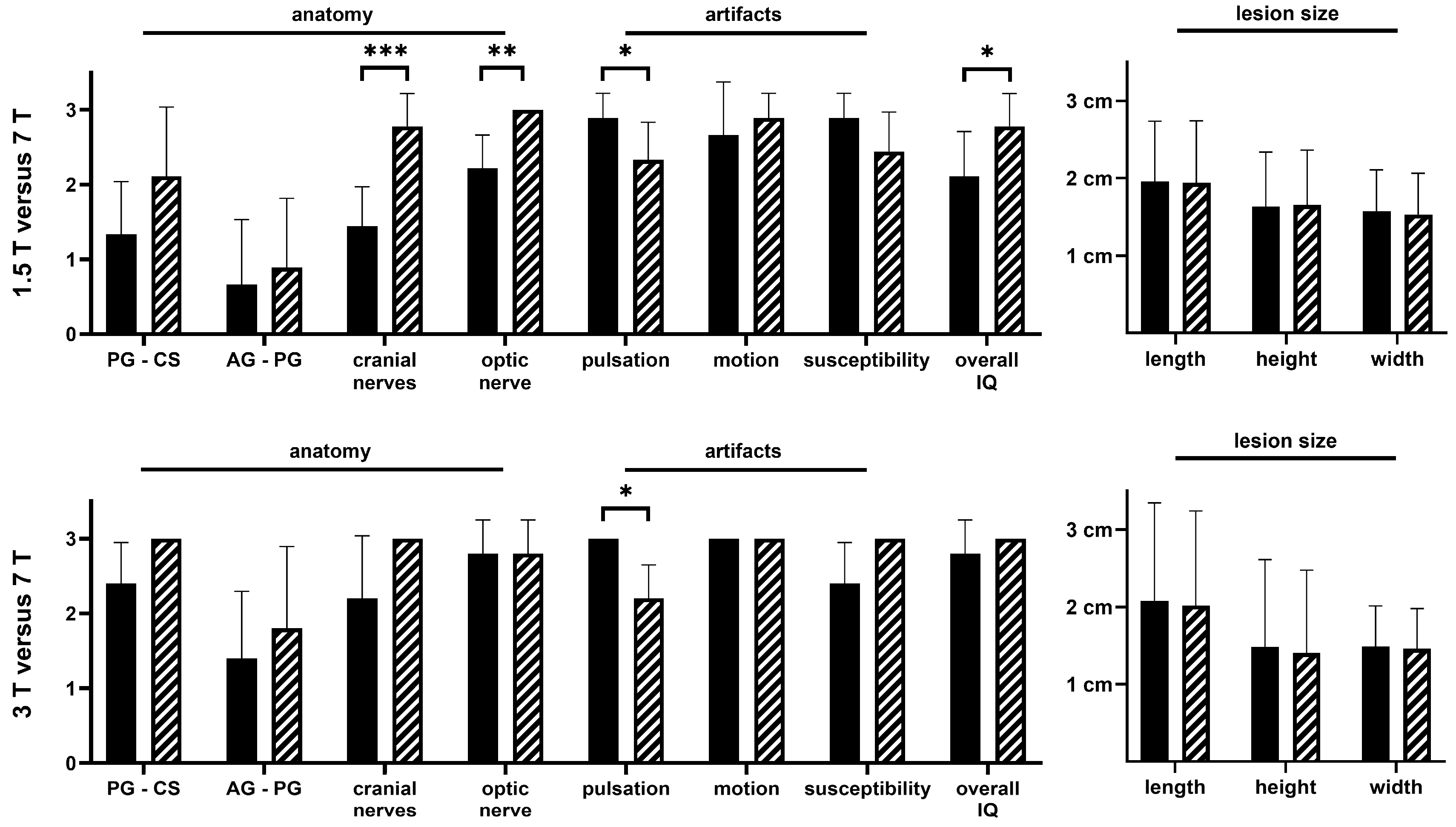 Life Free Full Text Improved Detection Of Cavernous Sinus Invasion Of Pituitary