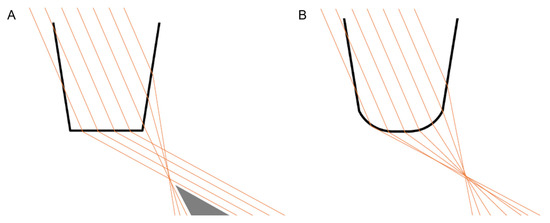 Dysphotopsias or Unwanted Visual Phenomena after Cataract Surgery