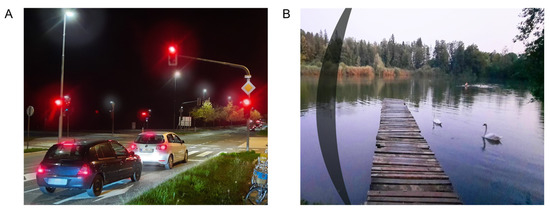 Dysphotopsias or Unwanted Visual Phenomena after Cataract Surgery