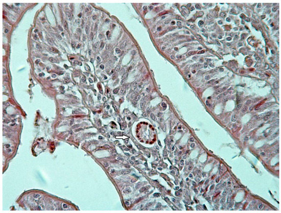 Production of Intestinal Mucins, sIgA, and Metallothionein after ...