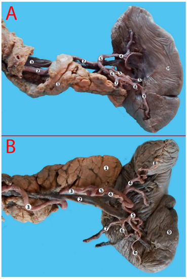 Morphological Evaluation of the Splenic Artery, Its Anatomical ...