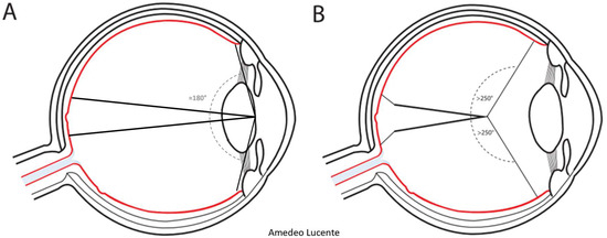 Widefield and Ultra-Widefield Retinal Imaging: A Geometrical Analysis