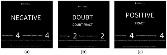 A Prospective Approach to Integration of AI Fracture Detection Software ...