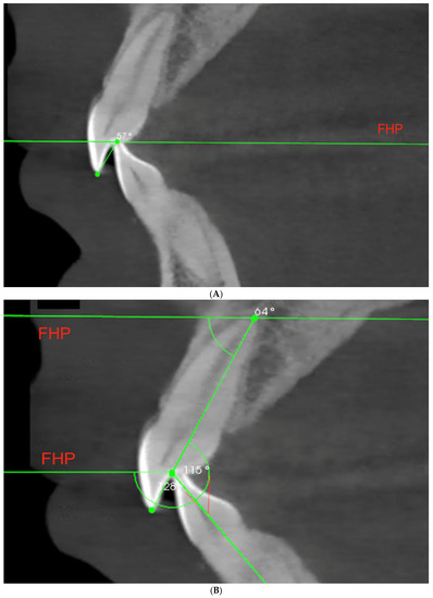 Life | Free Full-Text | Complicated Relationships between Anterior and ...