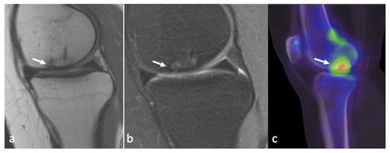 Imaging of Cartilage and Chondral Defects: An Overview