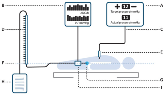 Assessment of Intra-Abdominal Pressure with a Novel Continuous Bladder Pressure Monitor—A ...