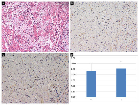 Wound Healing after Acellular Dermal Substitute Positioning in Dermato ...