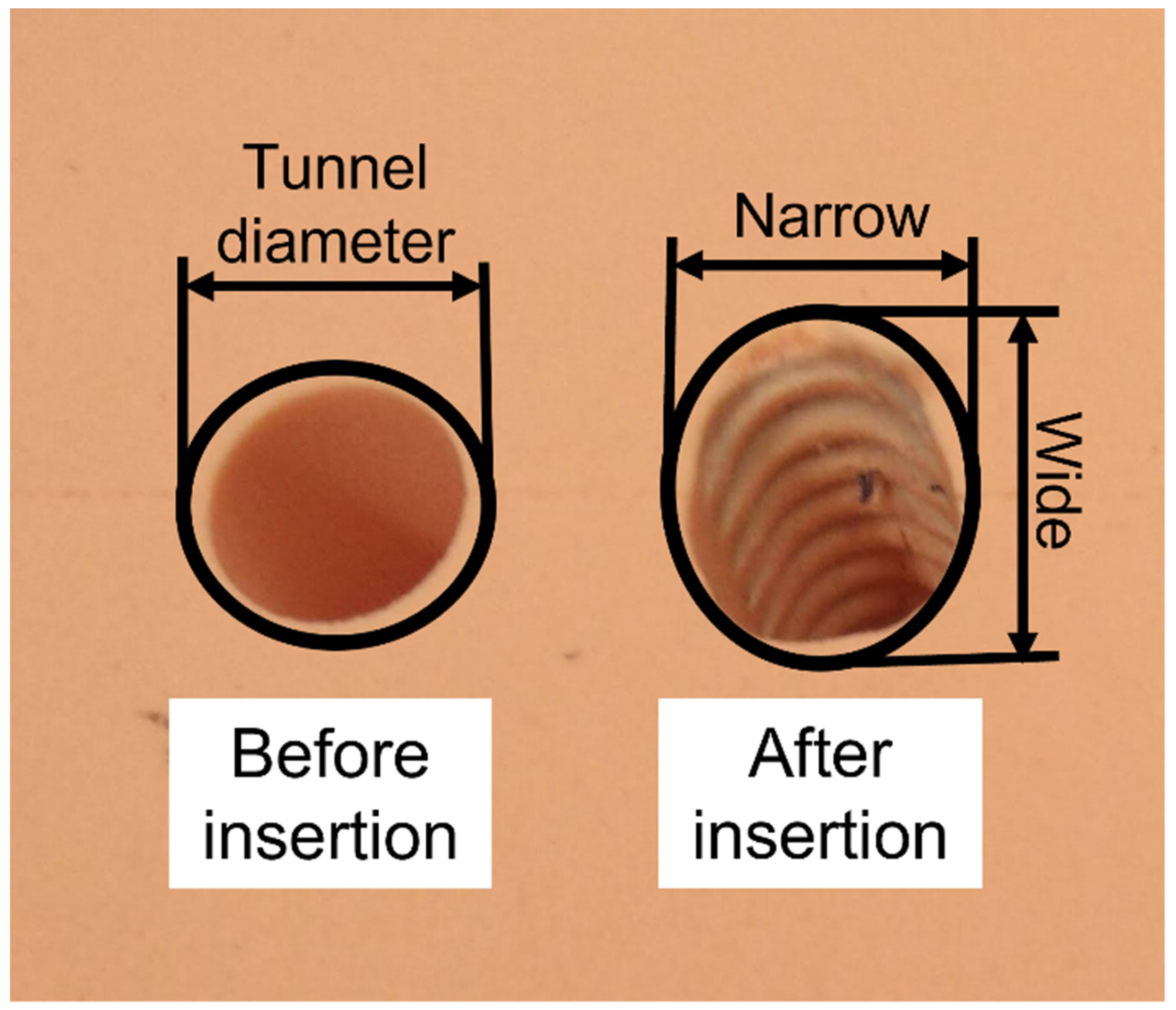 In Vitro Investigation of the Fixation Performance of a Bioabsorbable ...