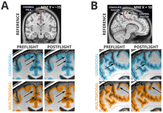 The Unresolved Methodological Challenge of Detecting Neuroplastic ...