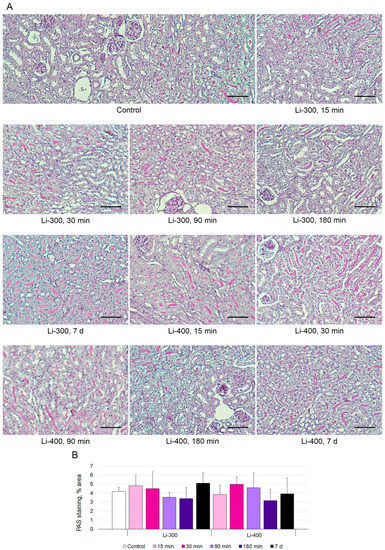Study of Lithium Biodistribution and Nephrotoxicity in Skin Melanoma ...