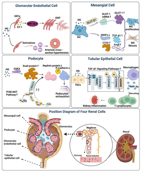 The Mechanism of Hyperglycemia-Induced Renal Cell Injury in Diabetic Nephropathy Disease: An Update