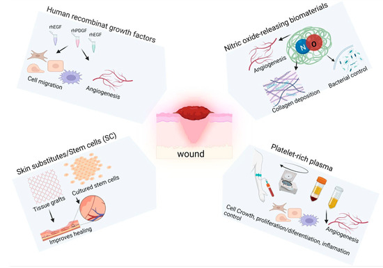 Photobiomodulation with Blue Light on Wound Healing: A Scoping Review