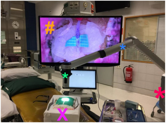 3D Exoscopes in Experimental Microanastomosis: A Comparison of ...