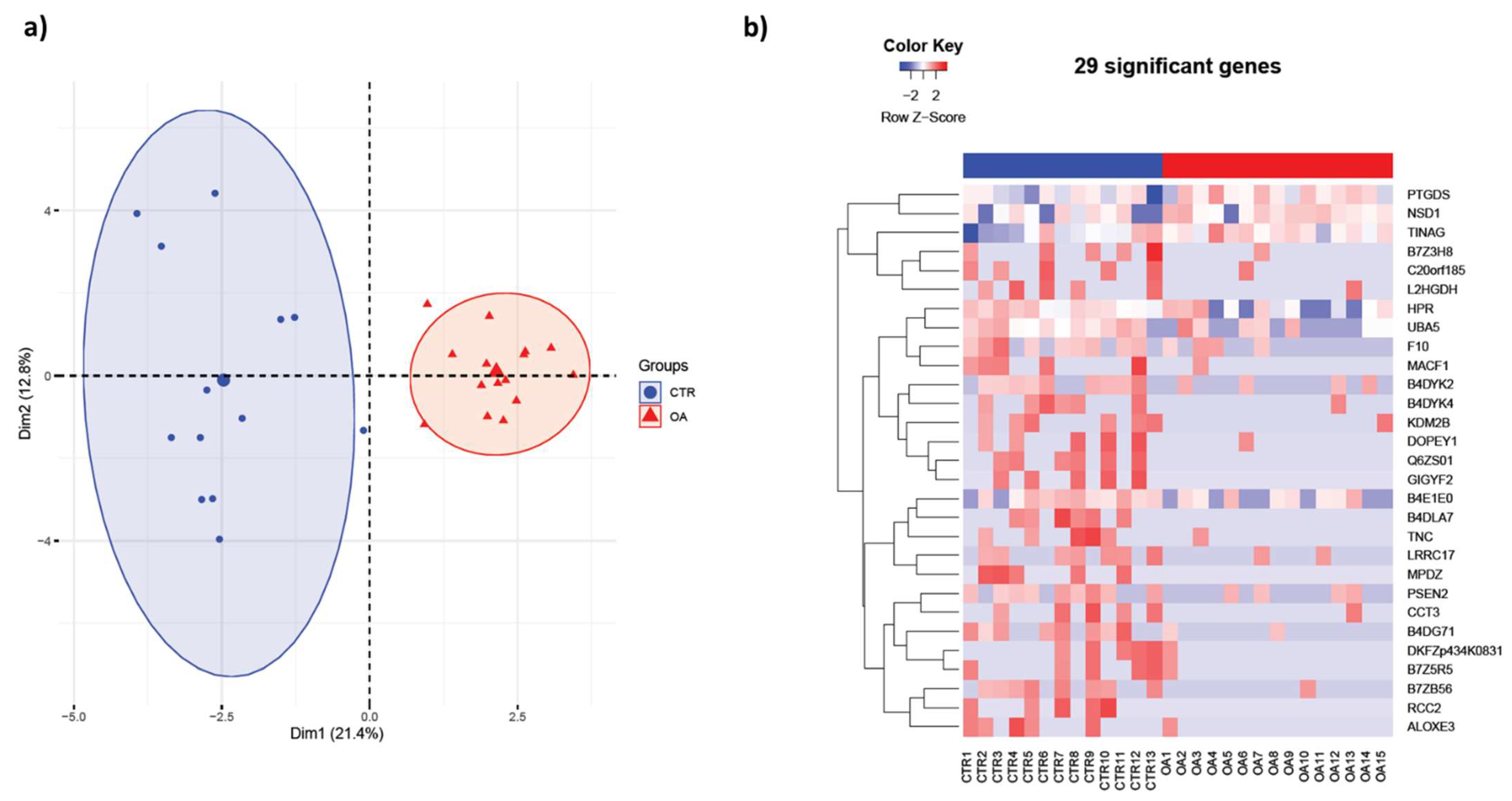 Proteomic Analysis of Female Synovial Fluid to Identify Novel ...