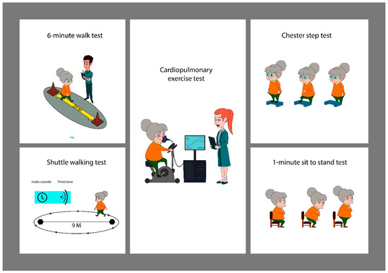 Life | Free Full-Text | Assessment of Exercise Capacity in Post-COVID ...