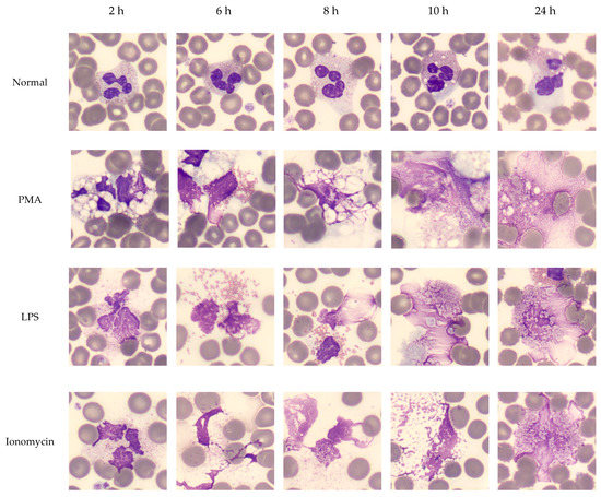 Identifying Neutrophil Extracellular Traps (NETs) in Blood Samples Using Peripheral Smear ...