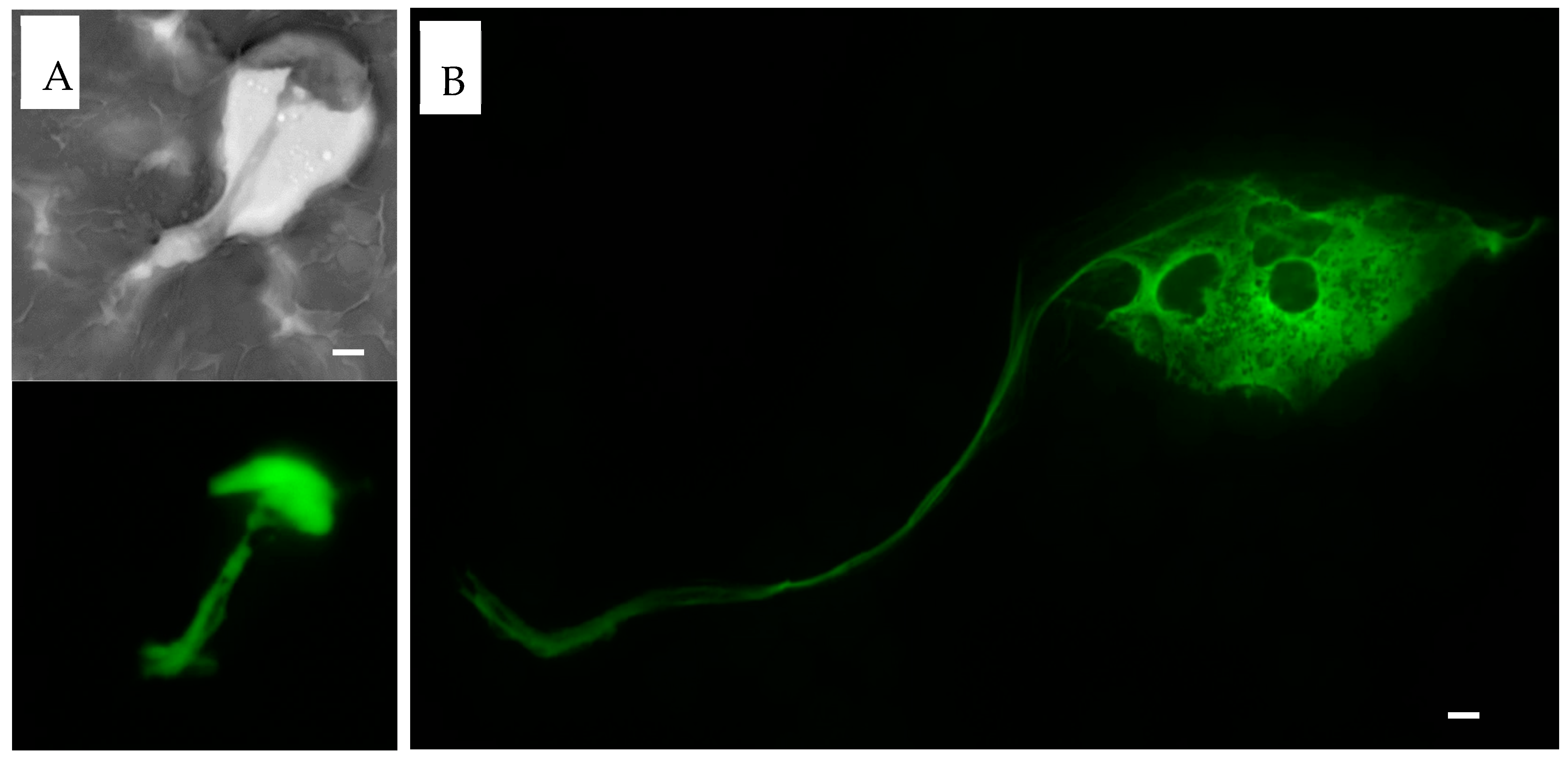 Identifying Neutrophil Extracellular Traps (NETs) in Blood Samples ...