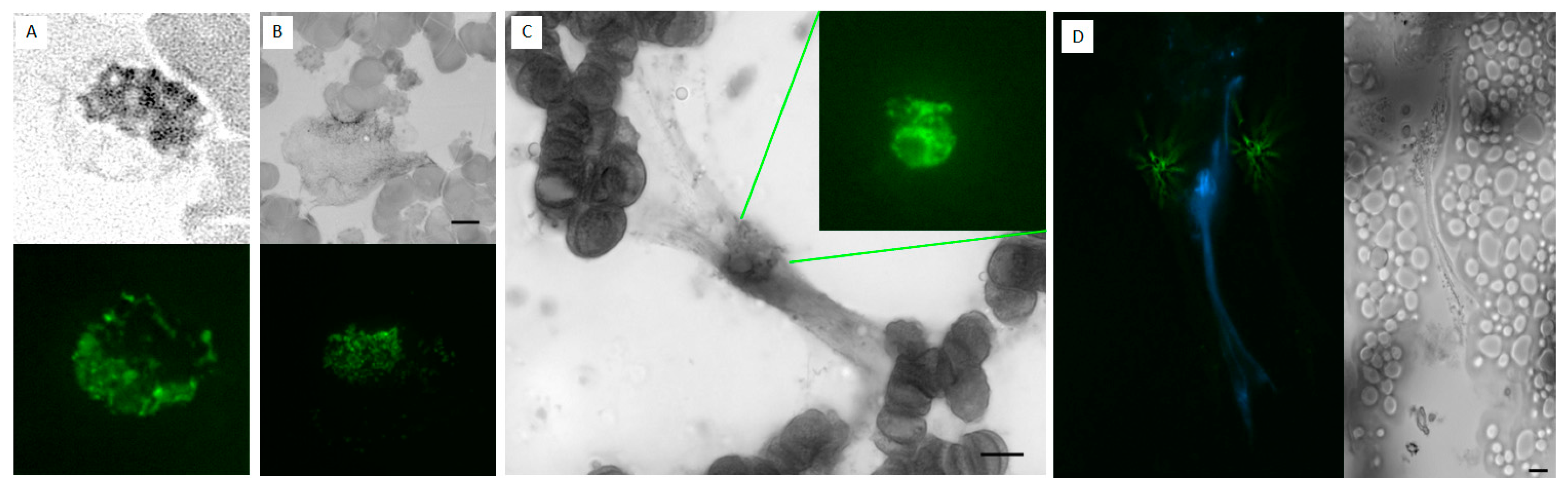 Identifying Neutrophil Extracellular Traps (NETs) in Blood Samples ...