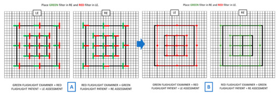Hess Lancaster Screen Test with Eye Tracker: An Objective Method for ...
