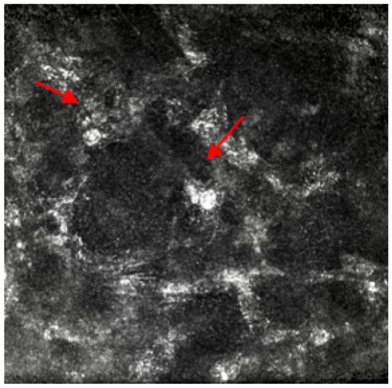 Enhancing Clinical Decision-Making in Complex Corneal Disorders: The ...