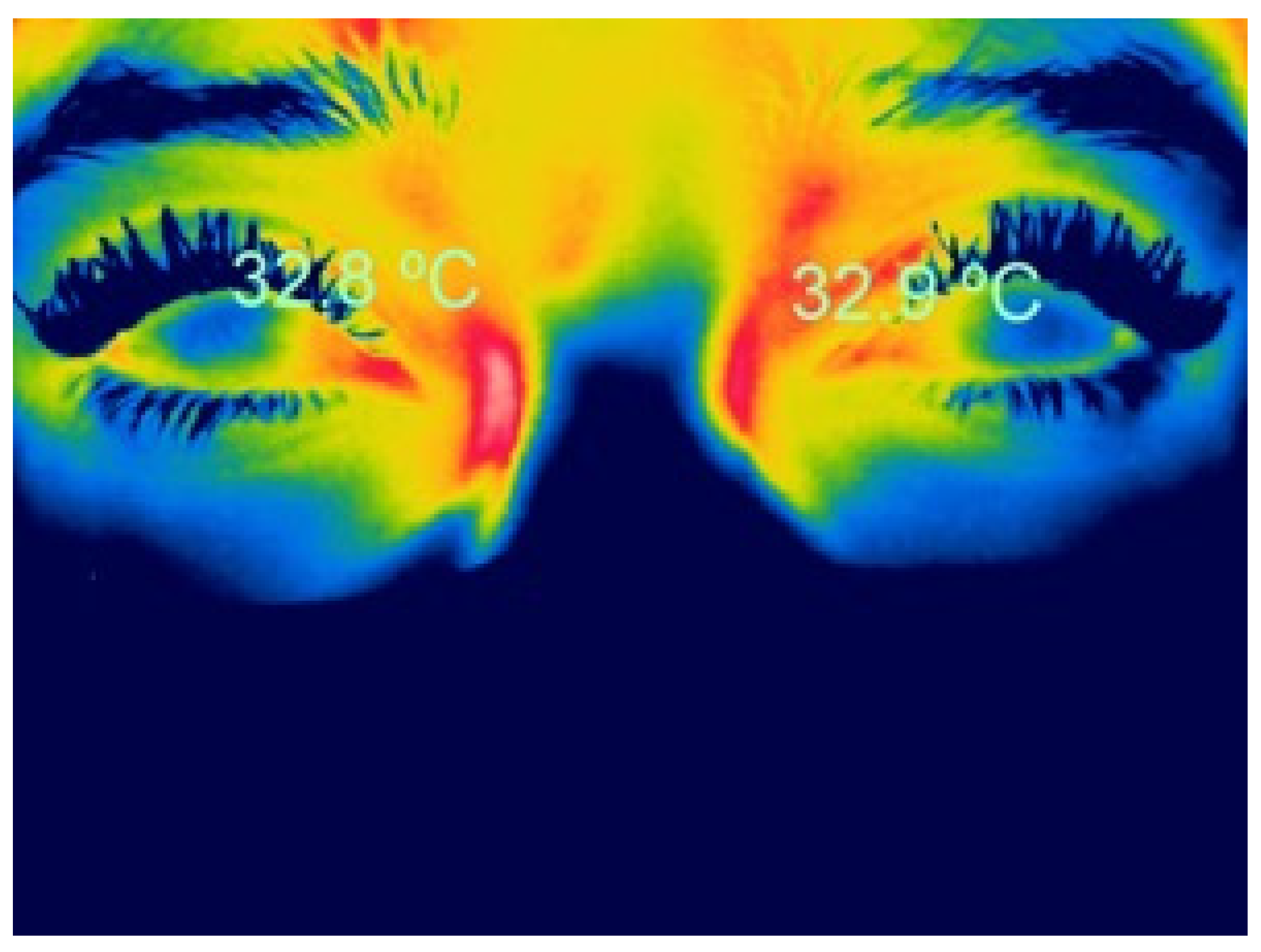 Life | Free Full-Text | Applications of Infrared Thermography in ... Life | Free Full-Text | Applications of Infrared Thermography in ...