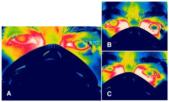 Applications of Infrared Thermography in Ophthalmology