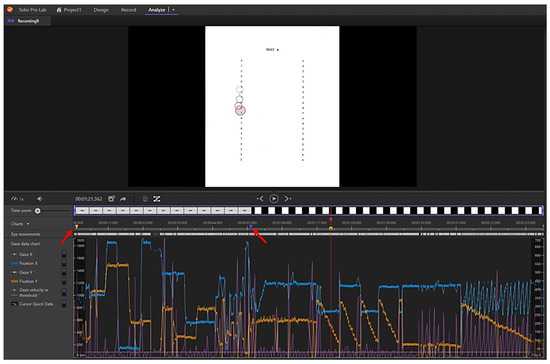Eye-Tracker Study of the Developmental Eye Movement Test in Young ...