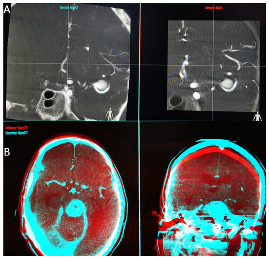 The Utility of Multimodal Imaging and Artificial Intelligence ...