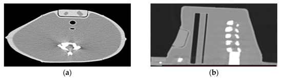 A Neck-Thyroid Phantom with Small Sizes of Thyroid Remnants for ...