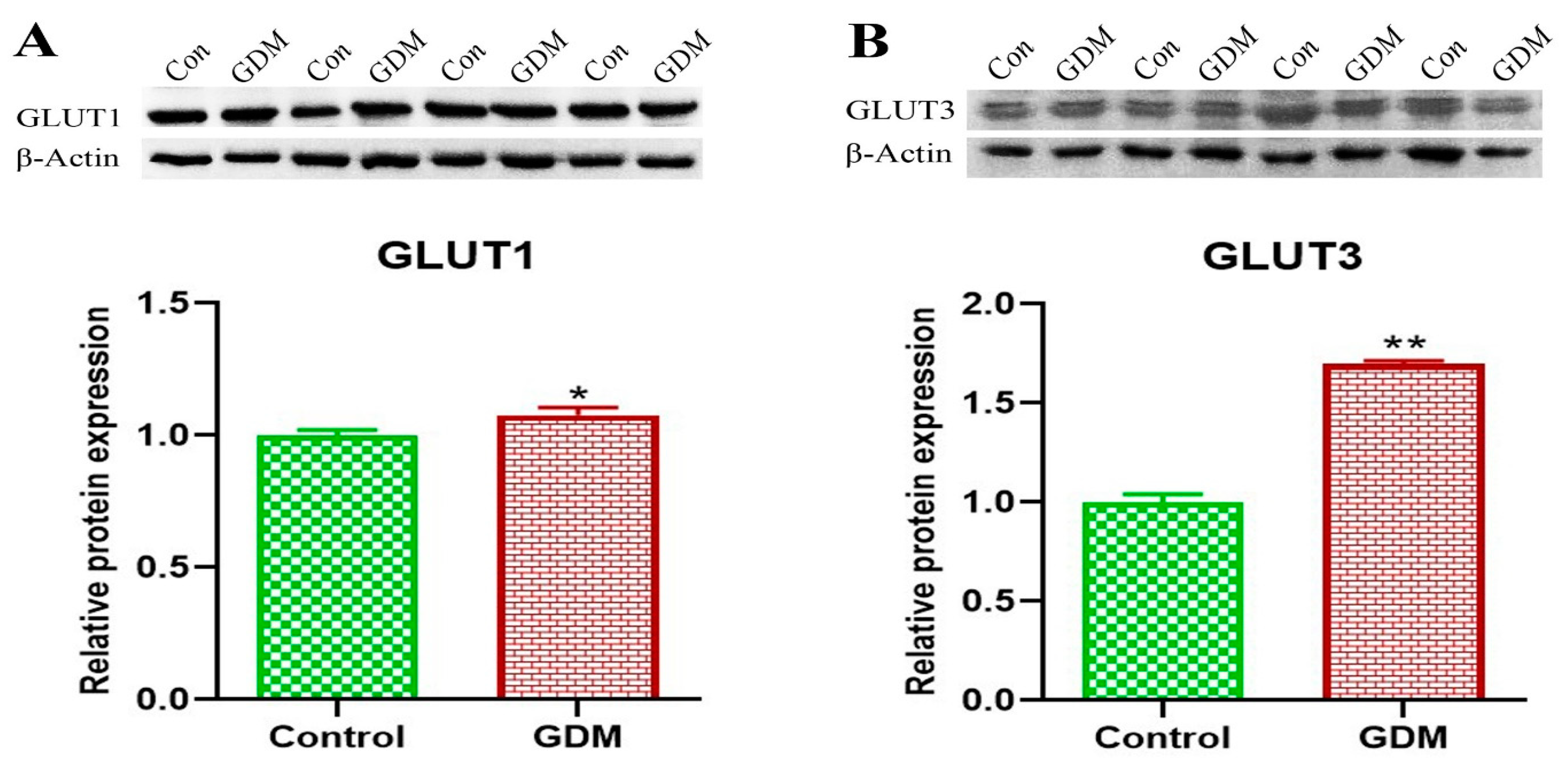 Expression of Glucose Transporters 1 and 3 in the Placenta of Pregnant Women with Gestational ...
