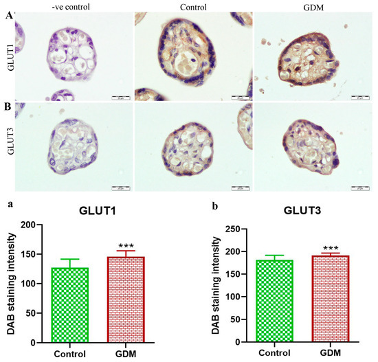 Expression of Glucose Transporters 1 and 3 in the Placenta of Pregnant Women with Gestational ...