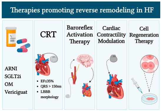 Cardiac Reverse Remodeling in Ischemic Heart Disease with Novel ...