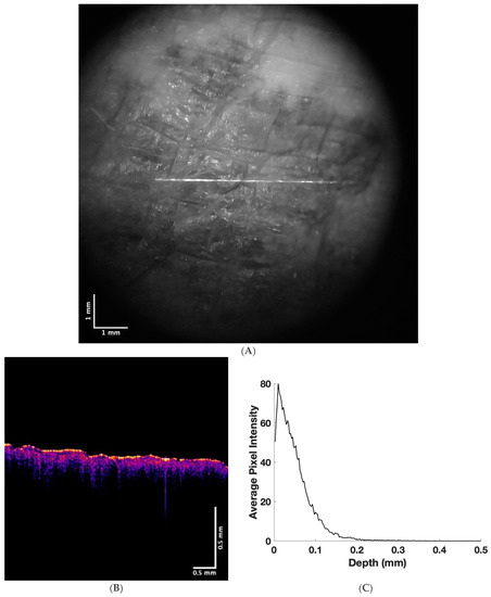 Melanin Stacking Differences in Pigmented and Non-Pigmented Melanomas ...