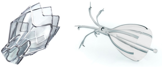 Life | Free Full-Text | Bronchoscopic Management of COPD and Advances ...