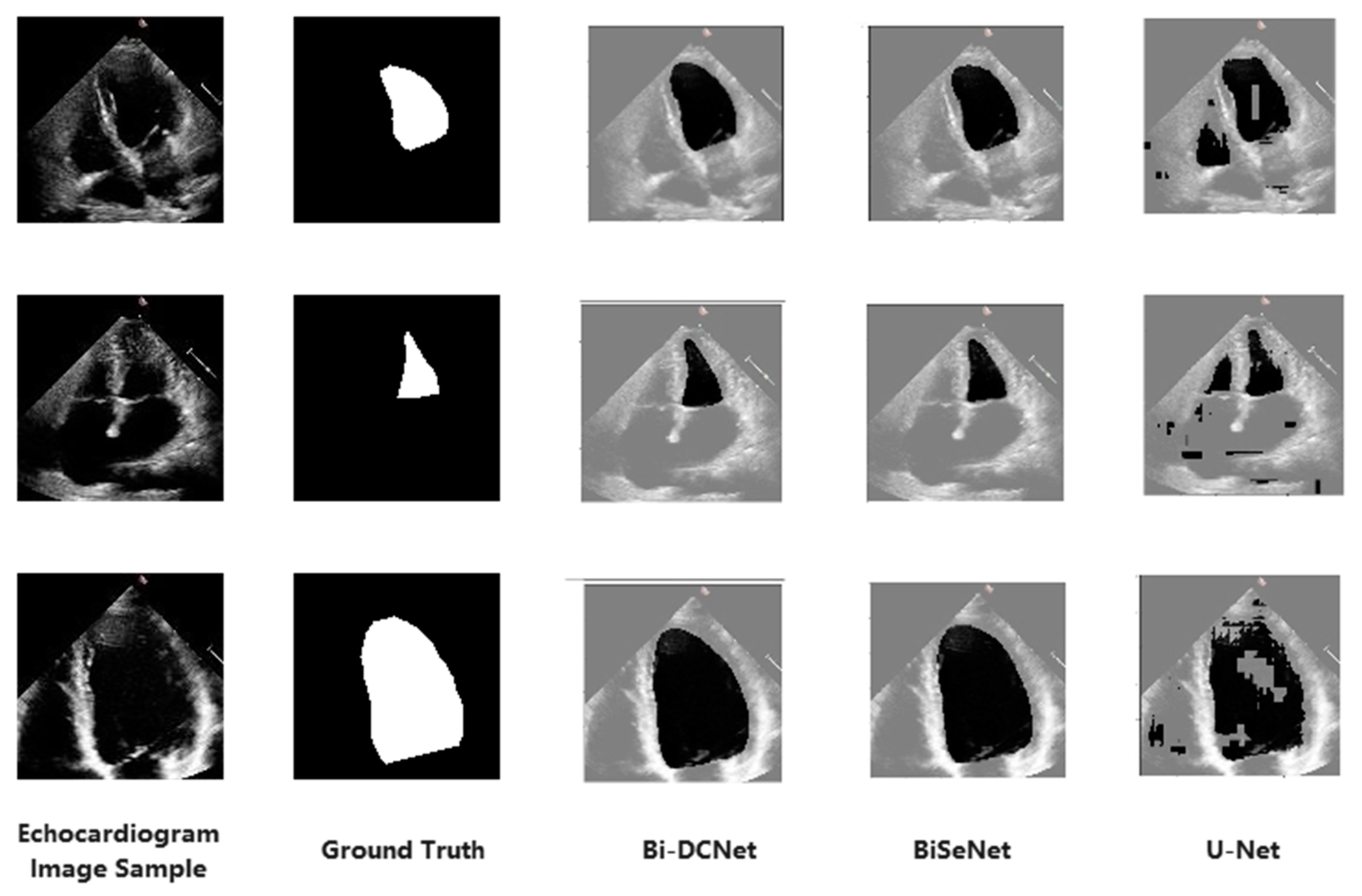 Bi-DCNet: Bilateral Network with Dilated Convolutions for Left ...