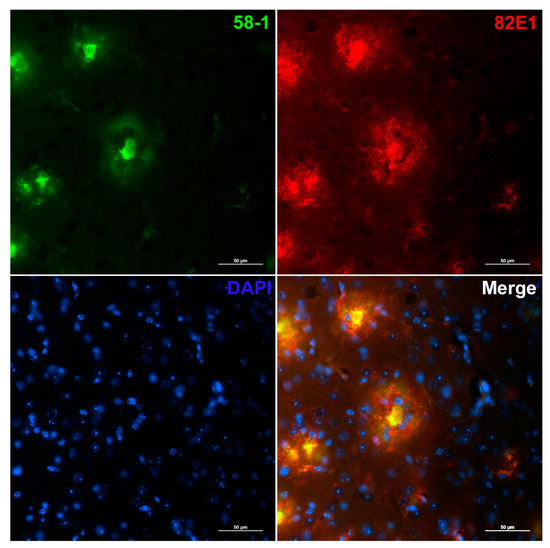 Brain Region-Specific Differences in Amyloid-β Plaque Composition in 5XFAD Mice