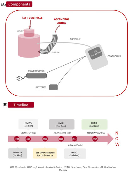 Left Ventricular Assist Device as a Destination Therapy: Current ...